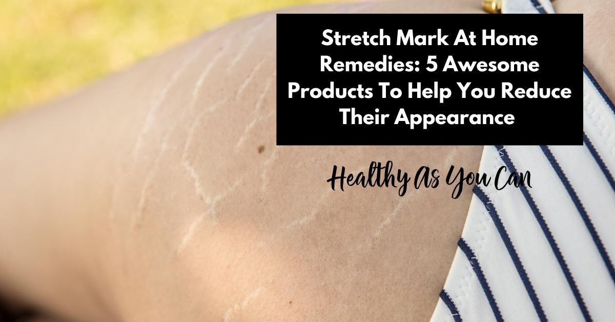 Stretch Mark At Home Remedies: 5 Awesome Products To Help You Reduce ...